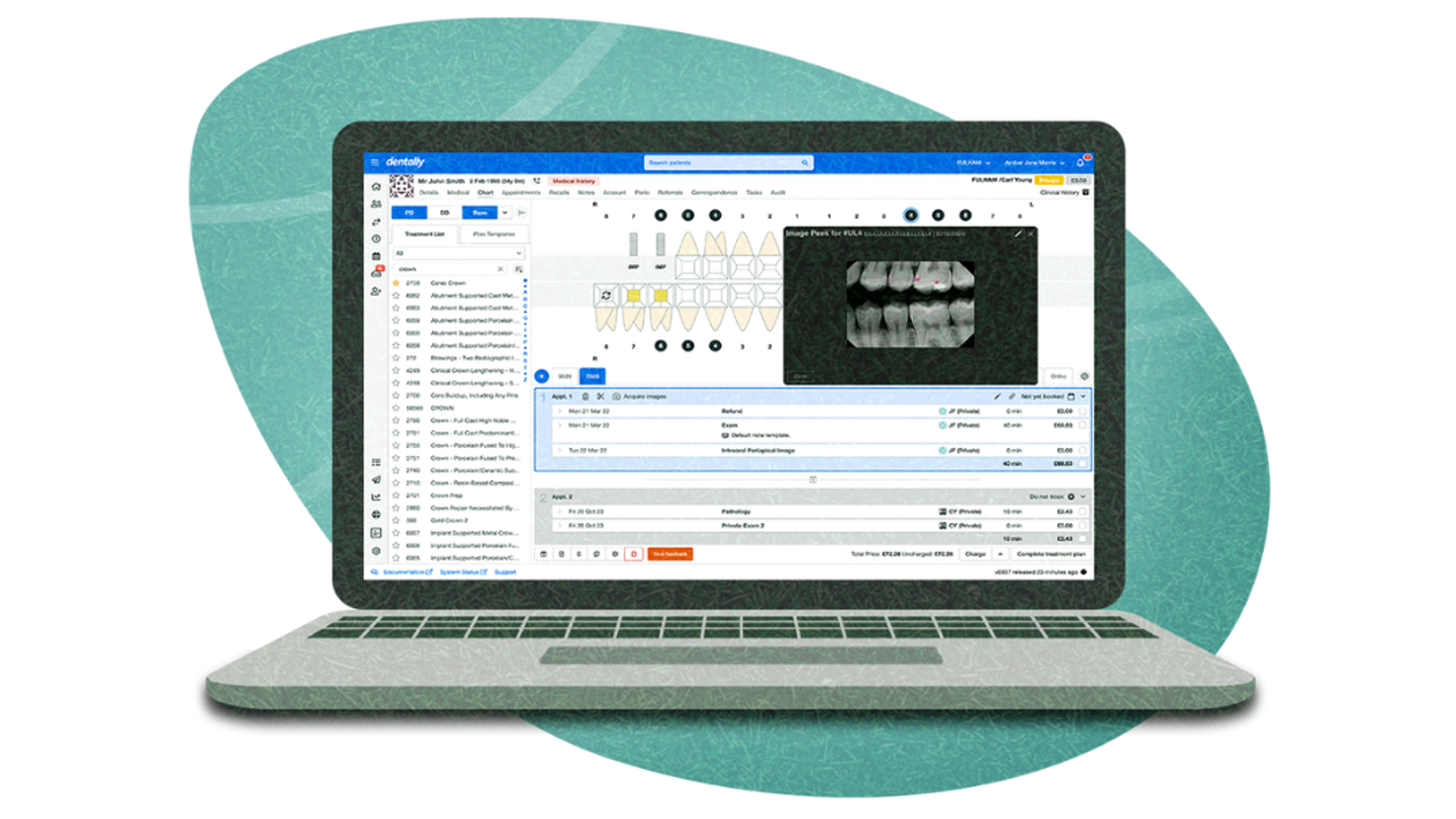 Dentally- Cloud Dental Software | Henry Schein One